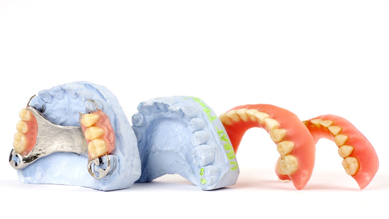 How Much Does a Unilateral Partial Denture Cost? - www thinksano.com