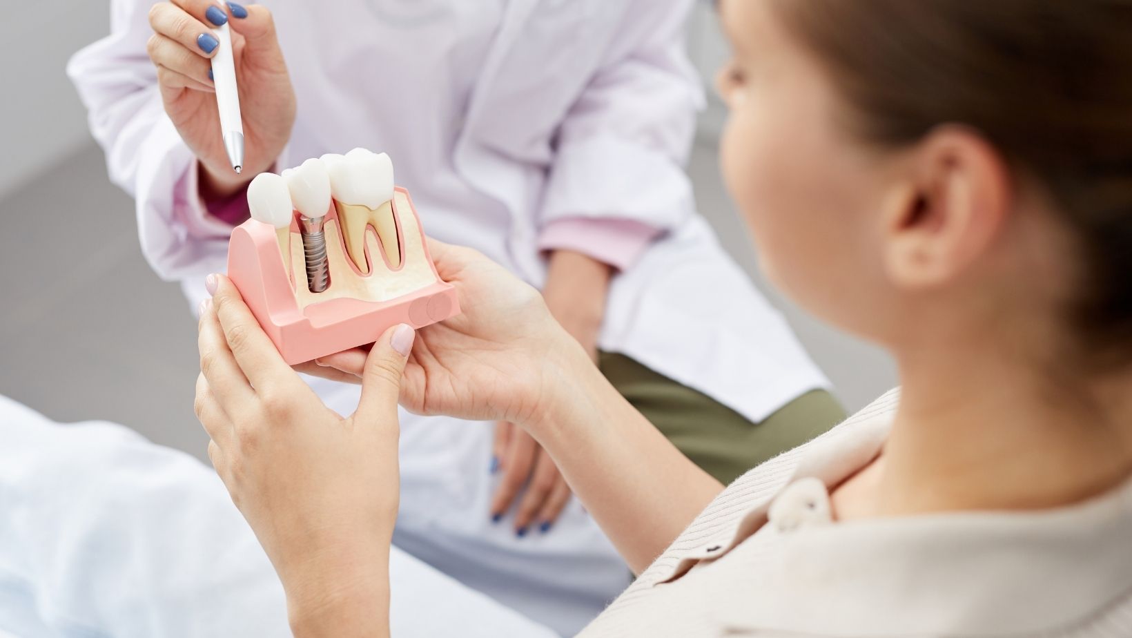Why Dental Implants Are Considered The Gold Standard For Tooth ...